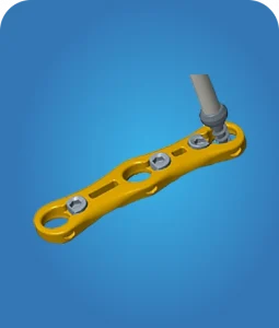 Fortis-ACP-Standard-&-Hana-Midline-Plate | OneSurg