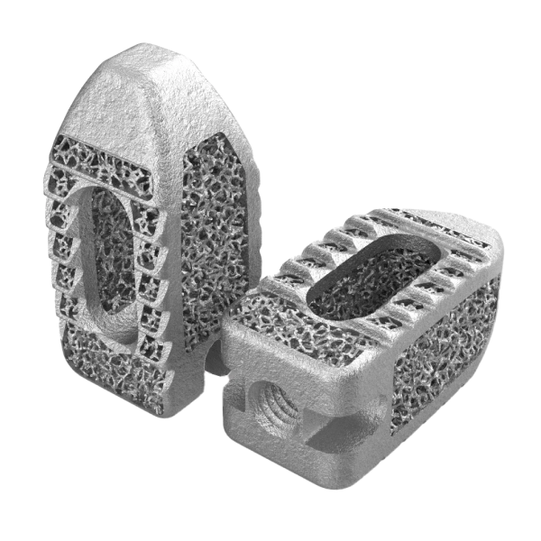 Pyxis™ TPLIF 3D-Titanium Cage | OneSurg